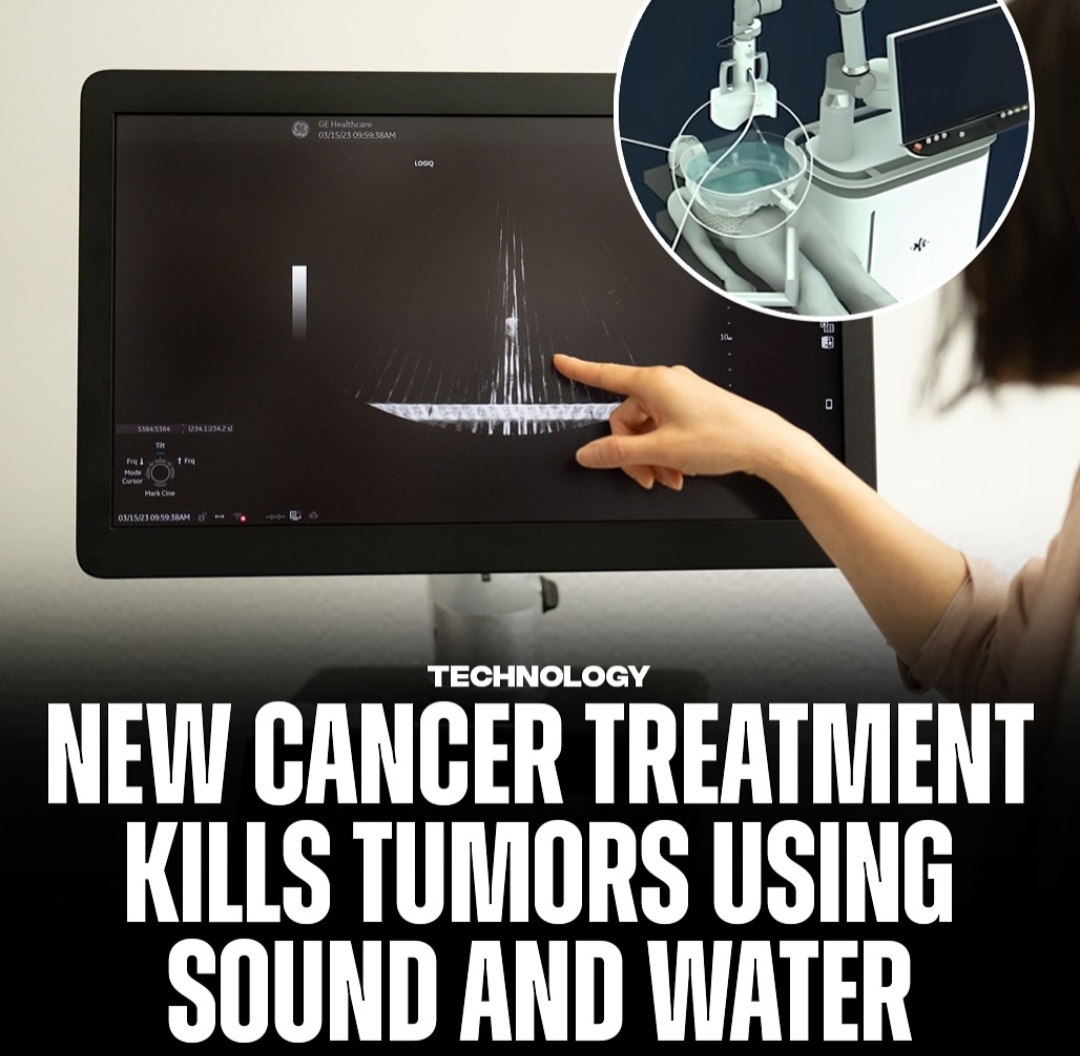 New Cancer Treatment From Sound and Water 💦🔊🤯